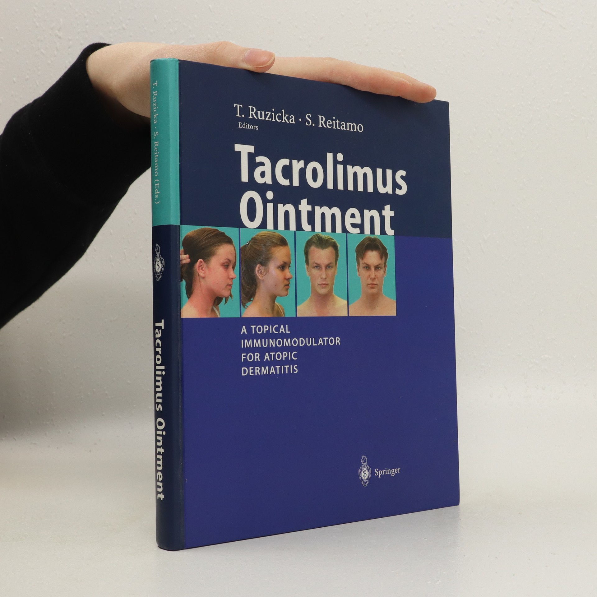 Tacrolimus ointment : a topical immunomodulator for atopic dermatitis ...
